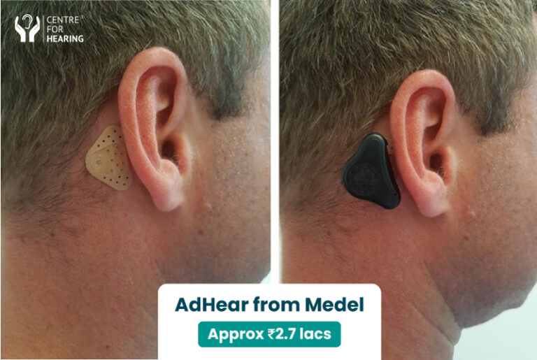 You’ll Never Believe How Bone Conduction Hearing Aids Work! (And How ...
