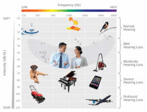 Pure Tone Audiometry: The Essential Hearing Test Explained - Centre For ...