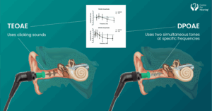 OAE Hearing Test: Early Detection of Hearing Loss